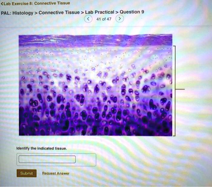 Connective Tissue > Lab Practical > Question 9 Identify the indicated ...