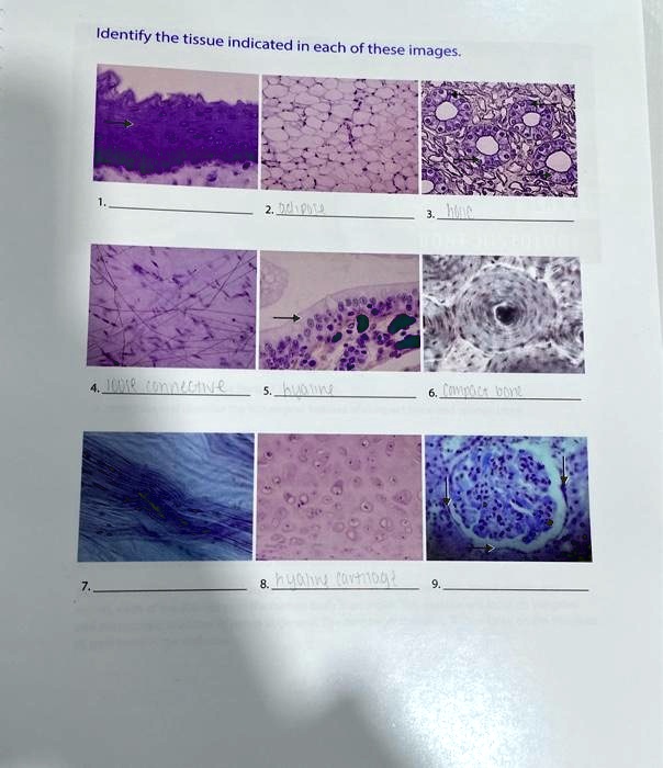 SOLVED: Texts: Identify the tissue indicated in each of these images. 1 ... SOLVED: Texts: Identify the tissue indicated in each of these images. 1 ...