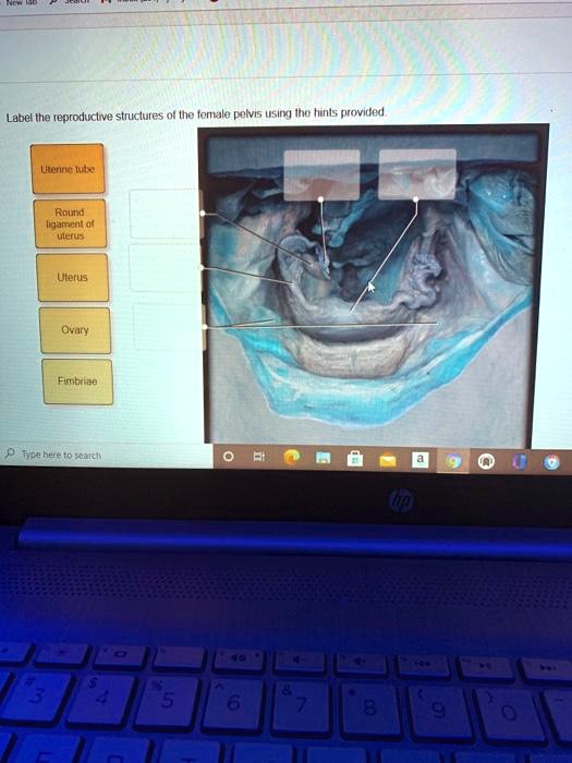 SOLVED: Label the reproductive structures of the female pelvis using the hints provided ...