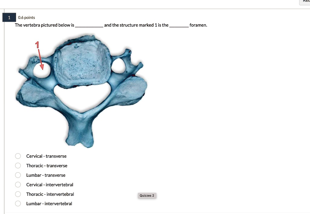 1 06 points the vertebra pictured below is and the structure marked 1 ...