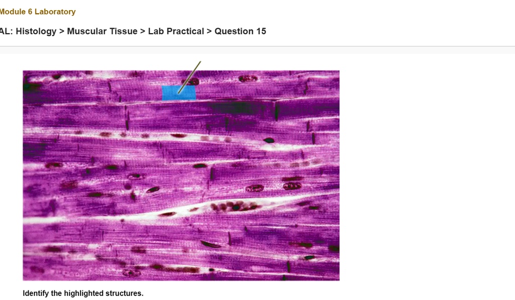 SOLVED: Module 6 Laboratory AL: Histology > Muscular Tissue > Lab Practical > Question 15 ...