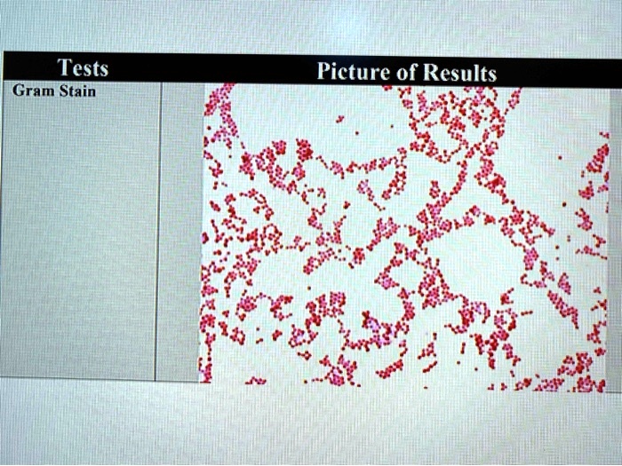 SOLVED: Tests Gram Stain Picture of Results