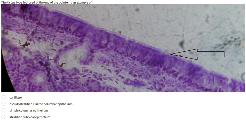 The tissue type featured at the end of the pointer is an example of ...