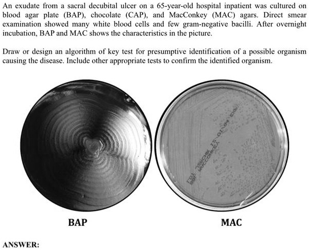 SOLVED: Can you answer this? Thanks! An exudate from a sacral decubital ...