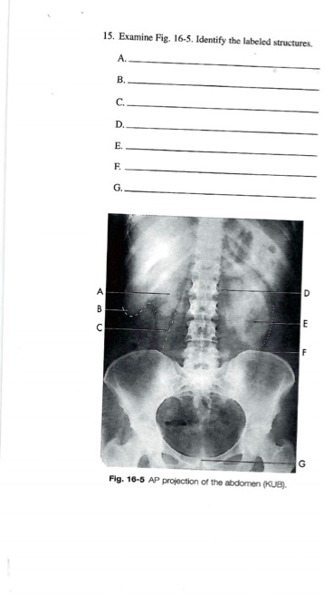 SOLVED: 15. Examine Fig. 16-5. Identify the labeled structures A, B, C ... SOLVED: 15. Examine Fig. 16-5. Identify the labeled structures A, B, C ...