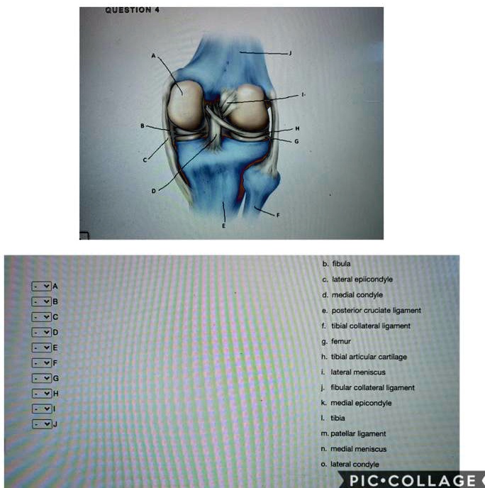 QUESTION 4 b. fibula c. lateral epicondyle d. medial condyle e ...