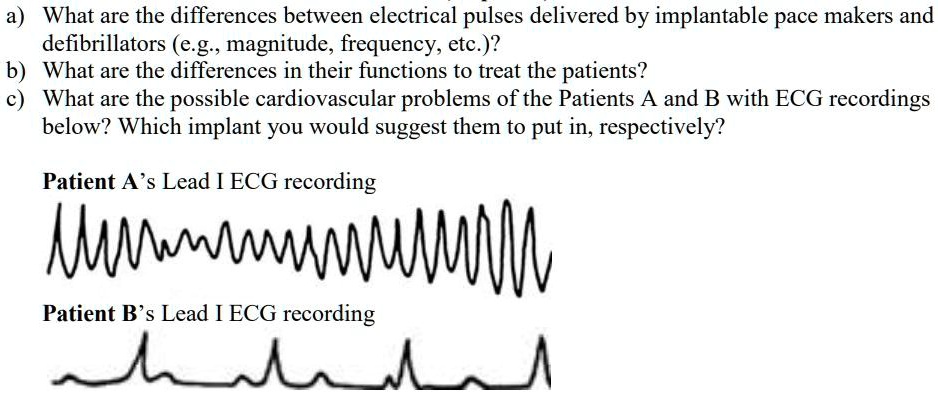 SOLVED: What are the differences between electrical pulses delivered by ...