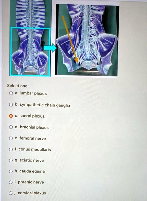 Select one: a. lumbar plexus b. sympathetic chain ganglia c. sacral ...