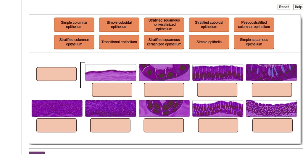 [GET ANSWER] Simple columnar epithelium Simple cuboidal epithelium Stratified squamous ...