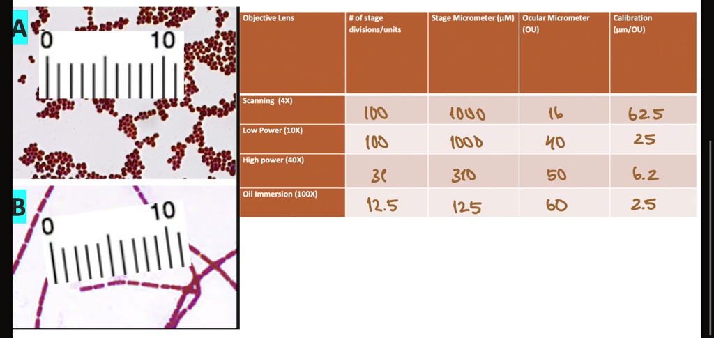 SOLVED: a) Describe the cell morphology seen in pictures (A) and (B) of ...