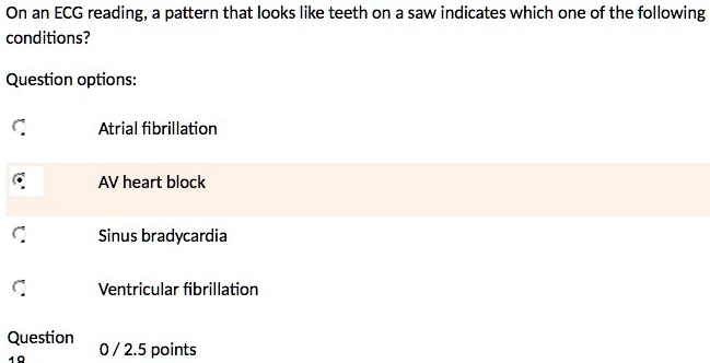 SOLVED: 'On an ECG reading; pattern that looks like teeth on saw ...