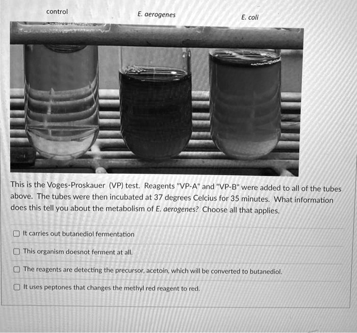 control e aerogenes e coli this is the voges proskauer vp test reagents ...