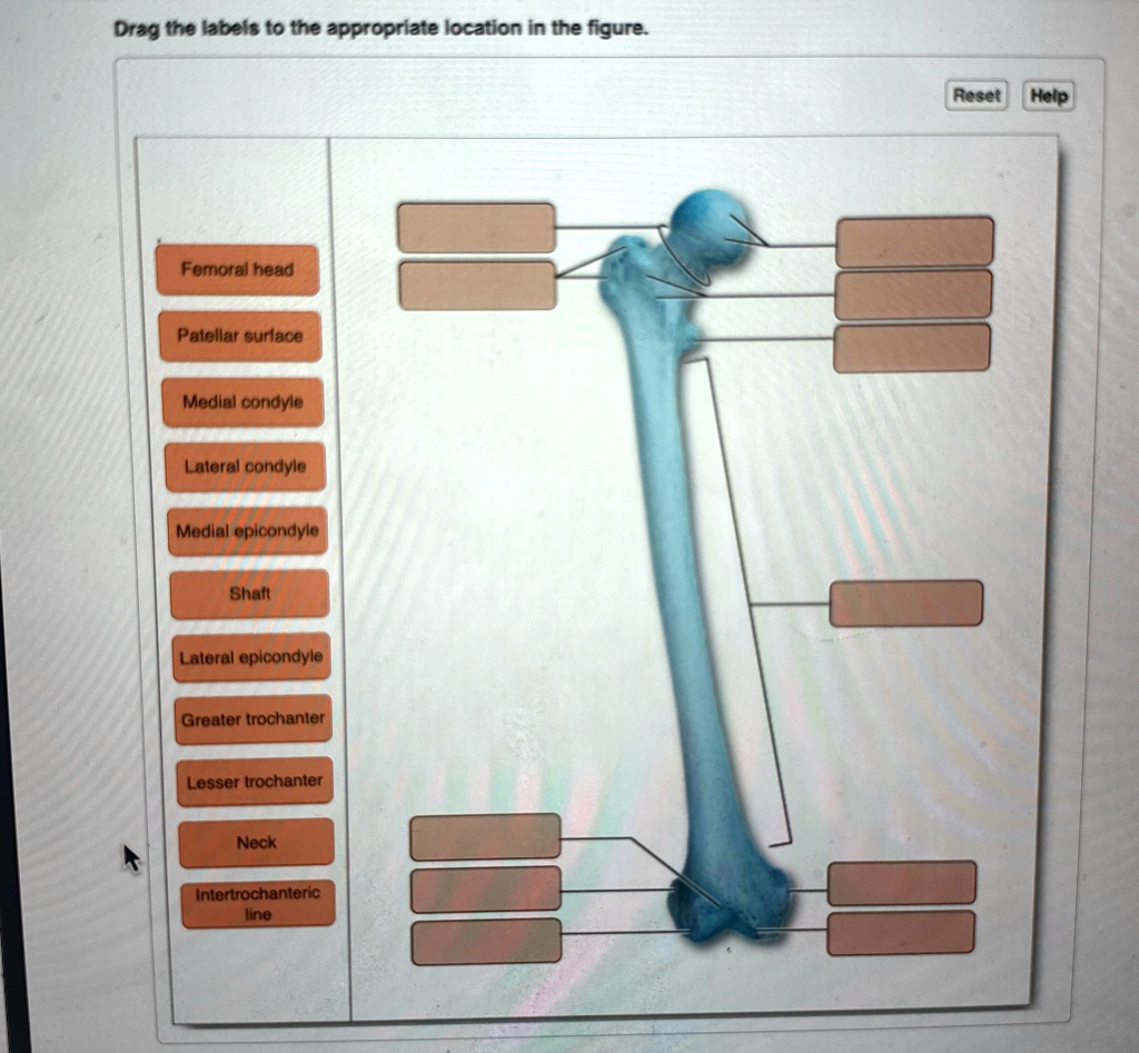 Drag the labels to the appropriate location in the figure. Femoral head ...