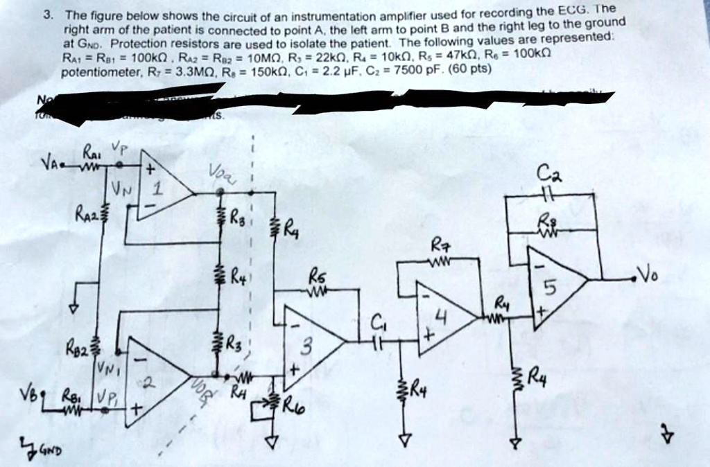 SOLVED: In the ECG amplifier circuit shown, calculate: a. The gain of ...