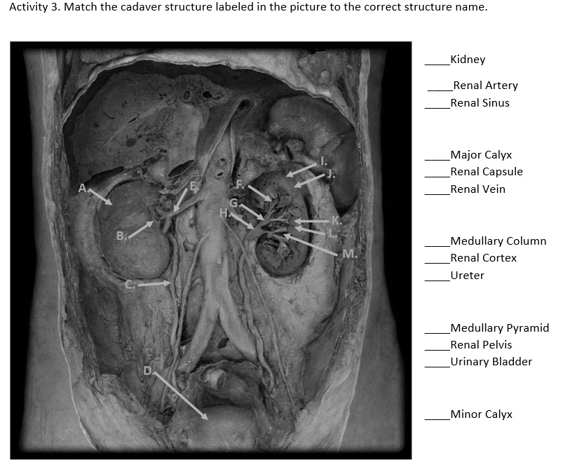 Activity 3. Match the cadaver structures labeled in the picture to the ...