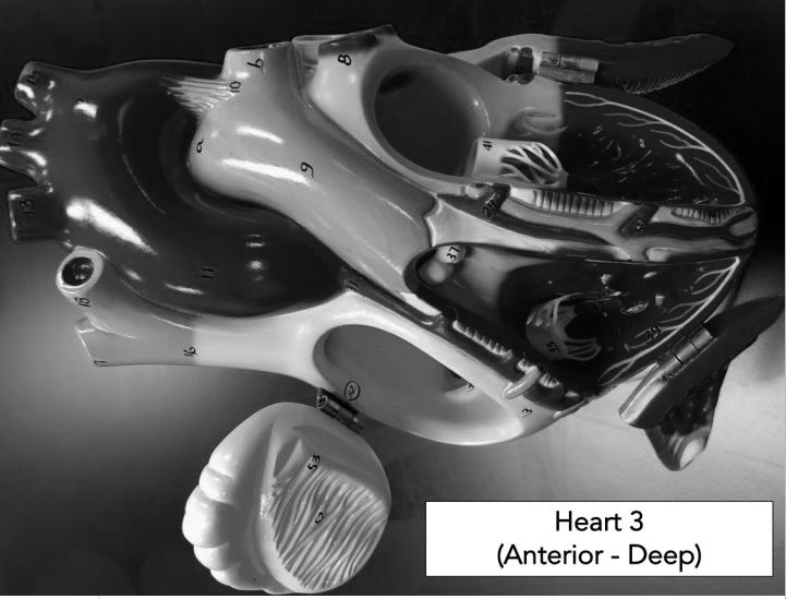 SOLVED: Label the superior vena cava, R atrium, L atrium, R ventricle ...