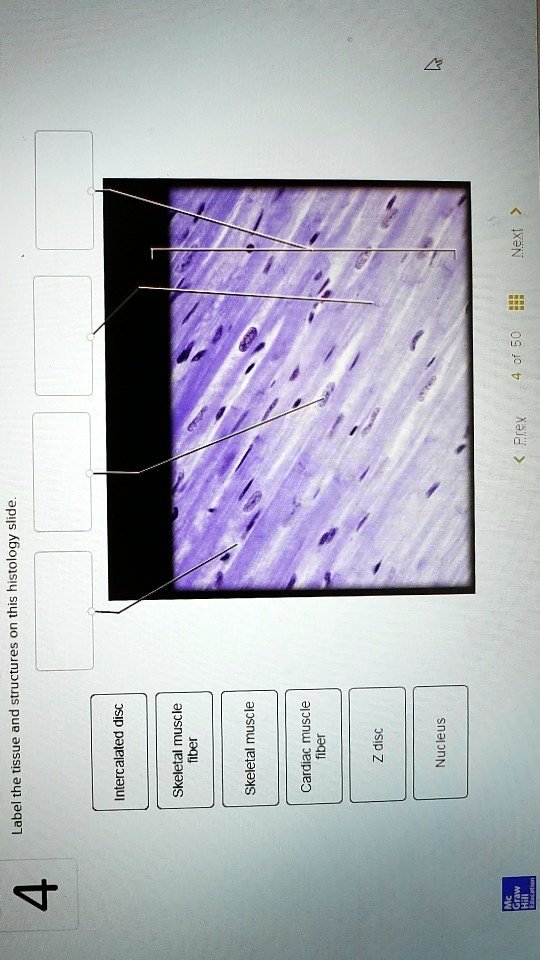 SOLVED: Label the tissue and structures on this histology slide ...