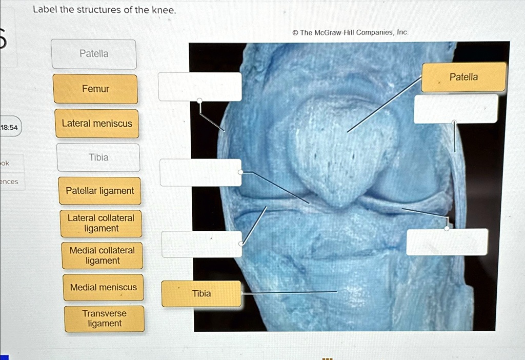 Label the structures of the knee. Patella Femur Lateral meniscus Tibia Patellar ligament Lateral ...