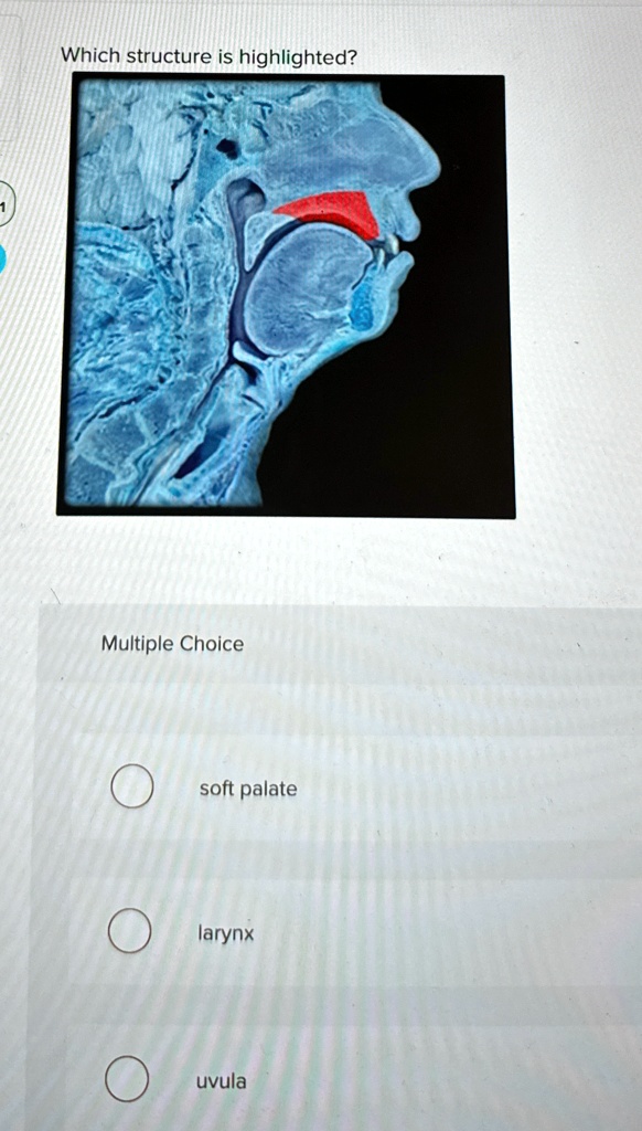 [GET ANSWER] Which structure is highlighted? Multiple Choice soft ...