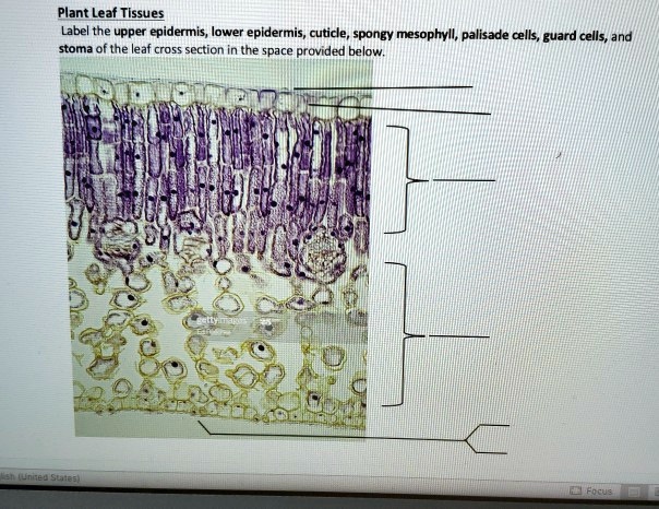 SOLVED: Plant Leaf Tissues Label the upper epidermis, lower epidermis ...
