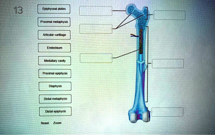 13 Epiphyseal plates Proximal metaphysis Articular cartilage Endosteum ...