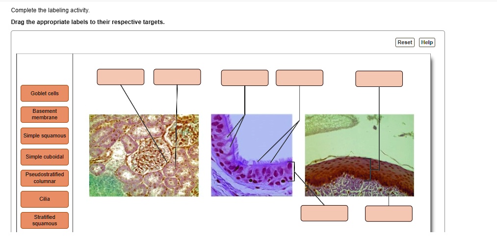 Complete the labeling activity. Drag the appropriate labels to their ...