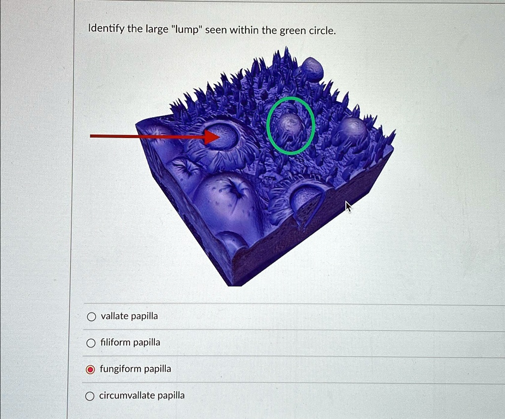 SOLVED: Identify the large "lump" seen within the green circle ...