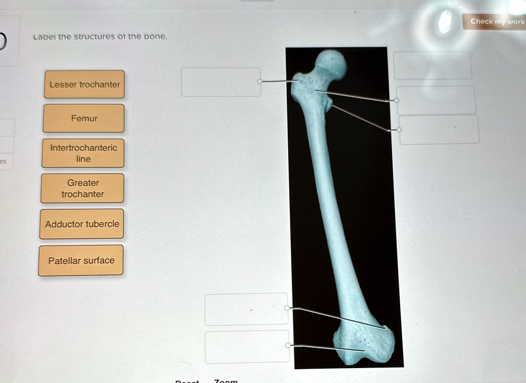 Label the structures of the bone. Lesser trochanter Femur ...