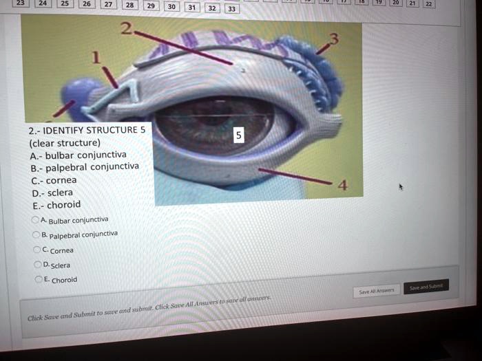 SOLVED: 3233 202122 2.-IDENTIFY STRUCTURE5 (clear structure) A.-bulbar ...