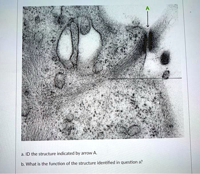 SOLVED: a. ID the structure indicated by arrow A b, What is the ...