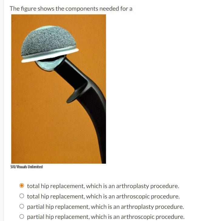 The figure shows the components needed for a SIU/Visuals Unlimited ...