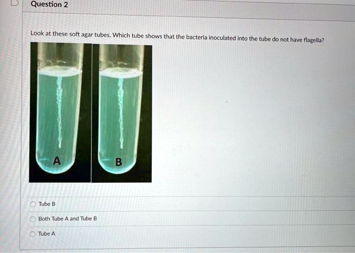 question 2 look at thesc soft agar tubes which tube shows that the ...