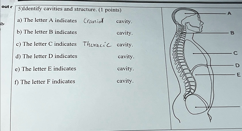 SOLVED: Identify cavities and structure. (1 point) a) The letter A ...