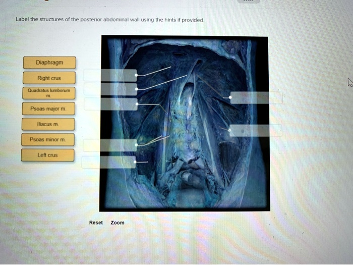 SOLVED: Label the structures of the posterior abdominal wall using the hints provided ...