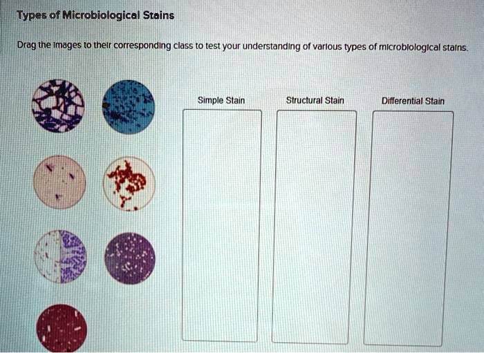 Types of Microbiological Stains Drag the images to their corresponding ...