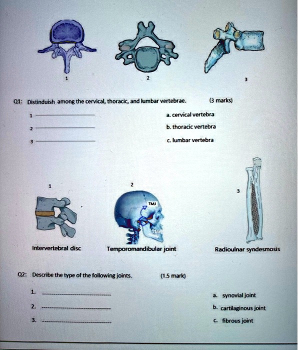 SOLVED: Distinguish among the cervical, thoracic, and lumbar vertebrae ...