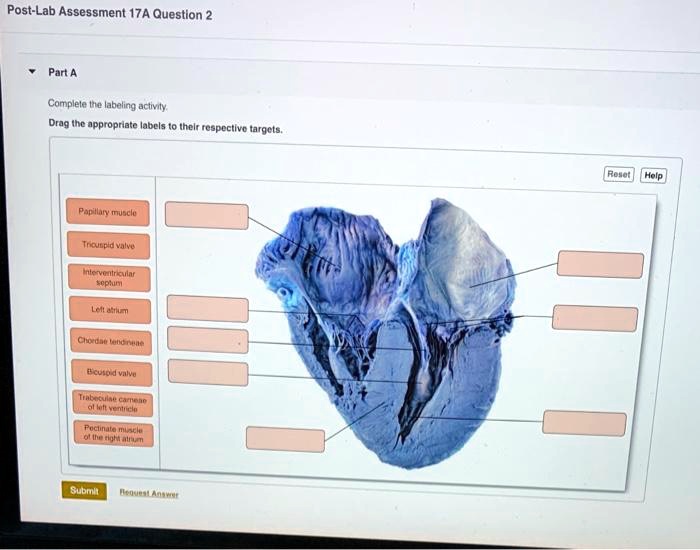 SOLVED: Part = Complete the labeling activity. Draw appropriate labels ...