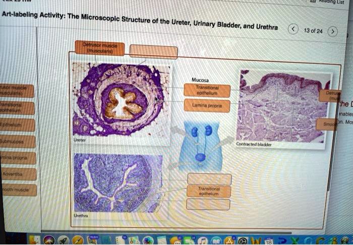 Art-labeling Activity: The Microscopic Structure of the Ureter, Urinary ...