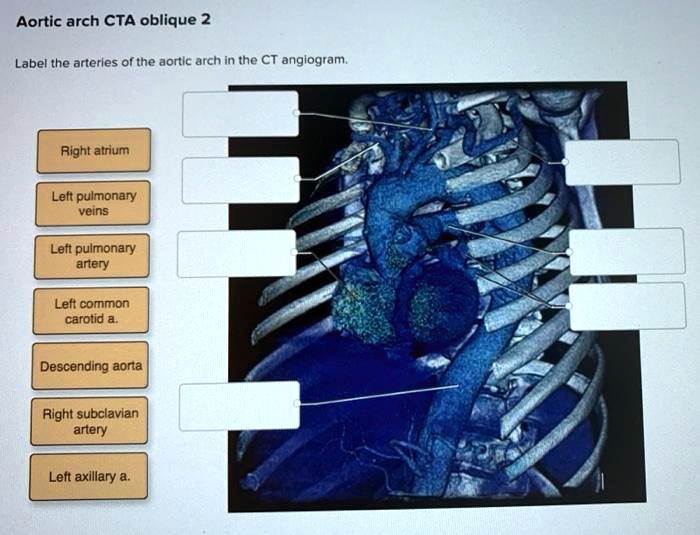 SOLVED: Label the arteries of the aortic arch in the CT angiogram ...