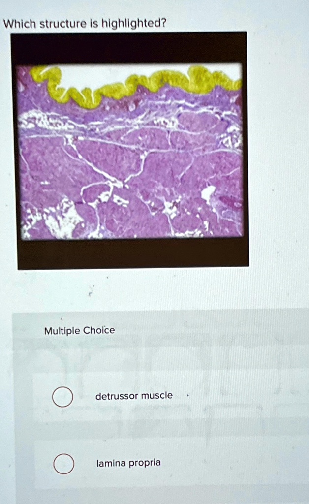 [GET ANSWER] Which structure is highlighted? Multiple Choice ? detrusor ...