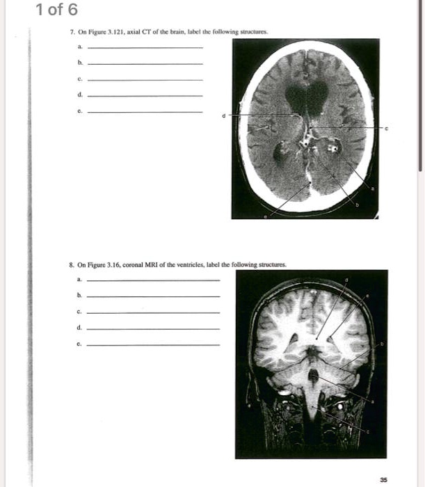 1 of 6 7. On Figure 3.121, axial CT of the brain, label the following ...