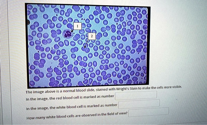 SOLVED: normal blood slide; stained with Wrights Stain to make the ...