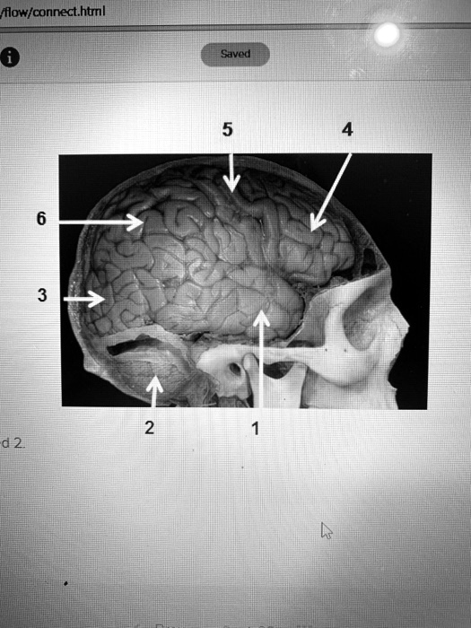 SOLVED: identify regions of the brain