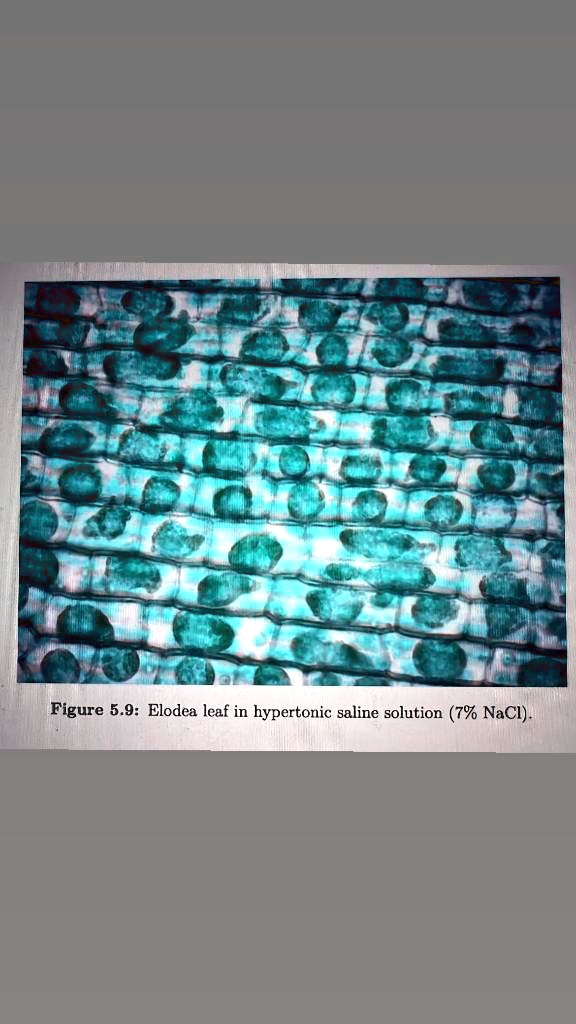 Figure 5.9: Elodea leaf in hypertonic saline solution (7% NaCl).