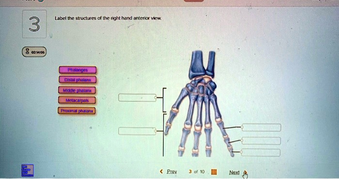 SOLVED: Label the structures of the right hand anterior view 3 ...