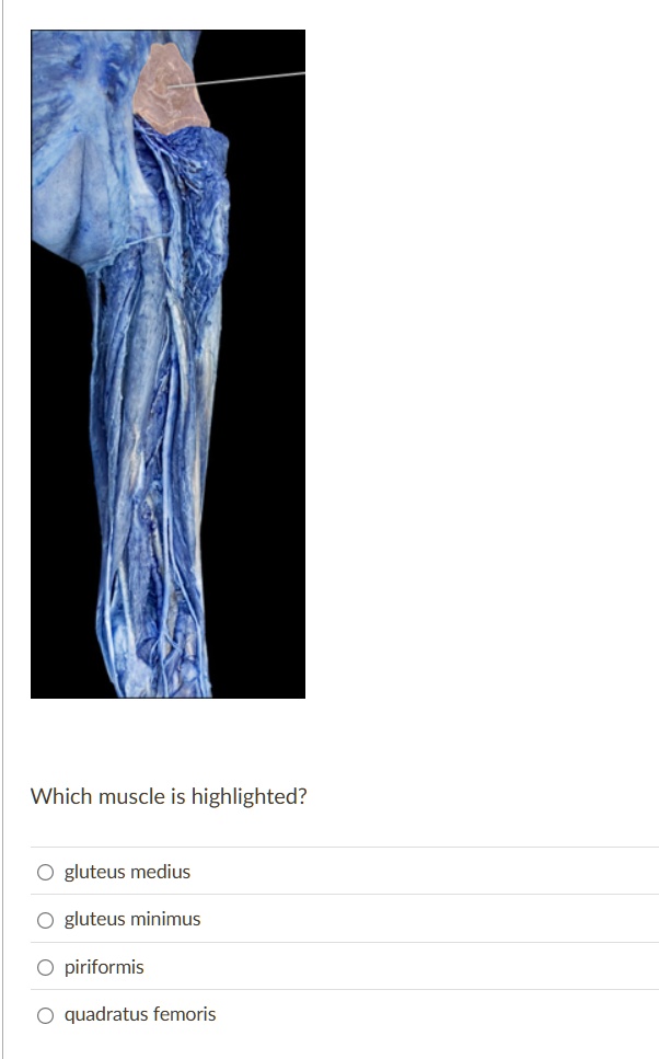 Which muscle is highlighted? ? gluteus medius ? gluteus minimus ...