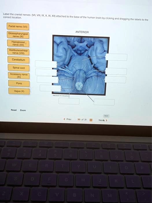 VIDEO solution: Label the cranial nerves VII, VIII, IX, X, XI, XII ...