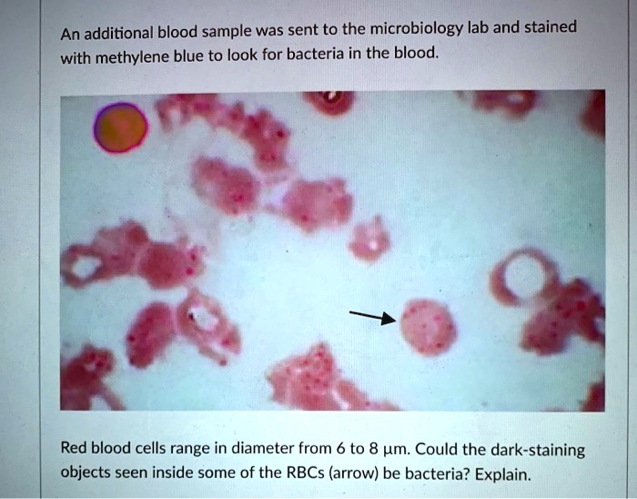 An additional blood sample was sent to the microbiology lab and stained ...