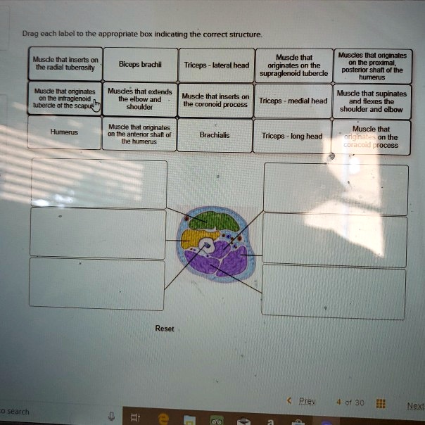 SOLVED: Muscle that inserts on the radial tuberosity Muscles that ...