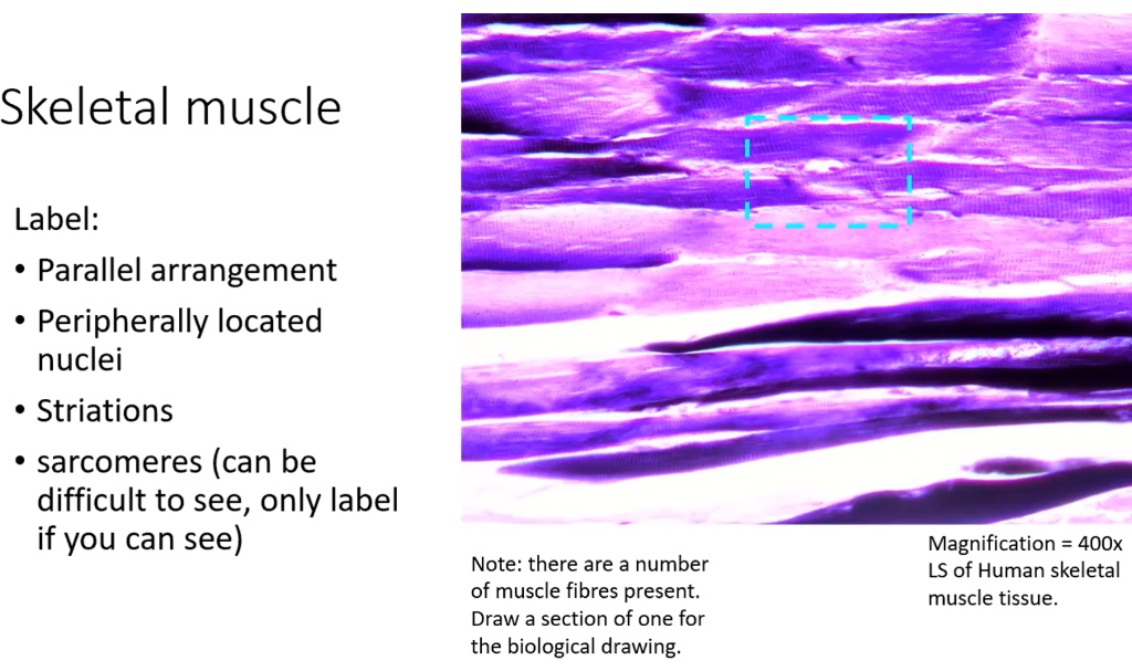SOLVED:Skeletal muscle Label: Parallel arrangement Peripherally located ...